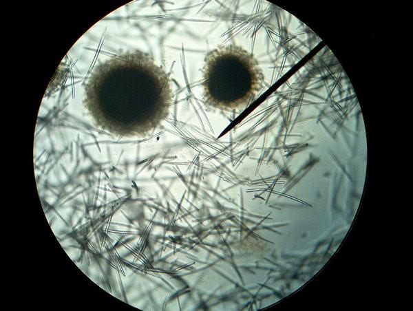 Spongilla Under Microscope